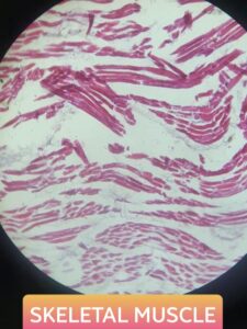 Histology Slides For MBBS 1st Year [With Identification Points ...