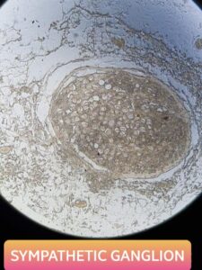 Histology Slides For MBBS 1st Year [With Identification Points ...