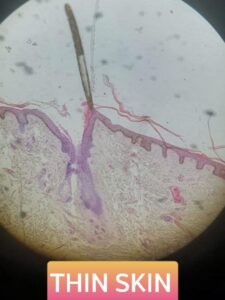 Histology Slides For MBBS 1st Year [With Identification Points ...